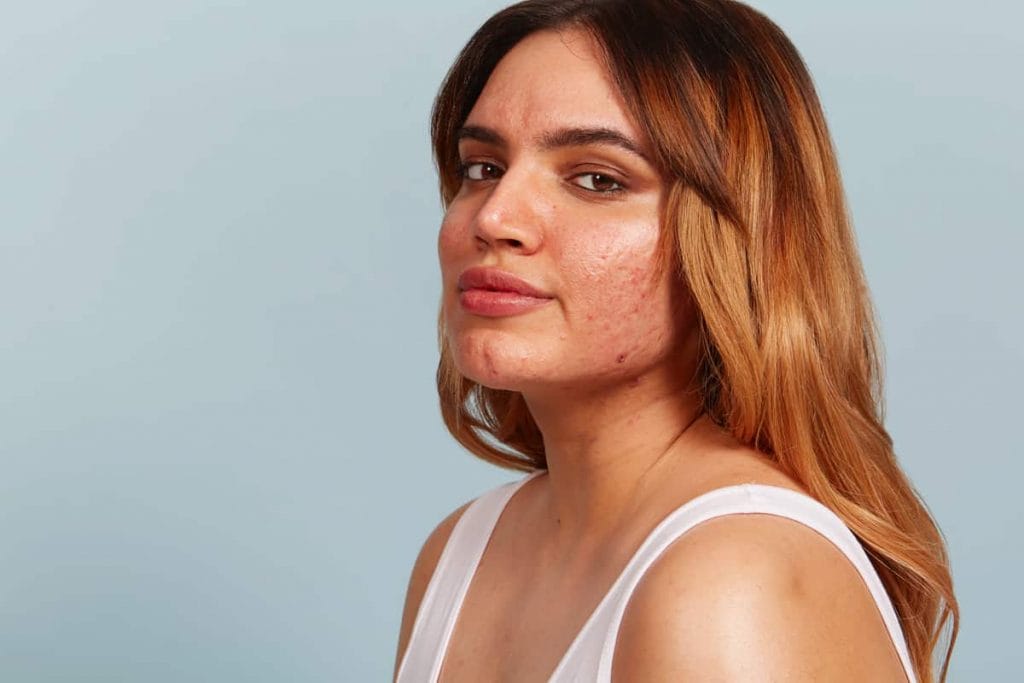 My Skin Story | Superdrug