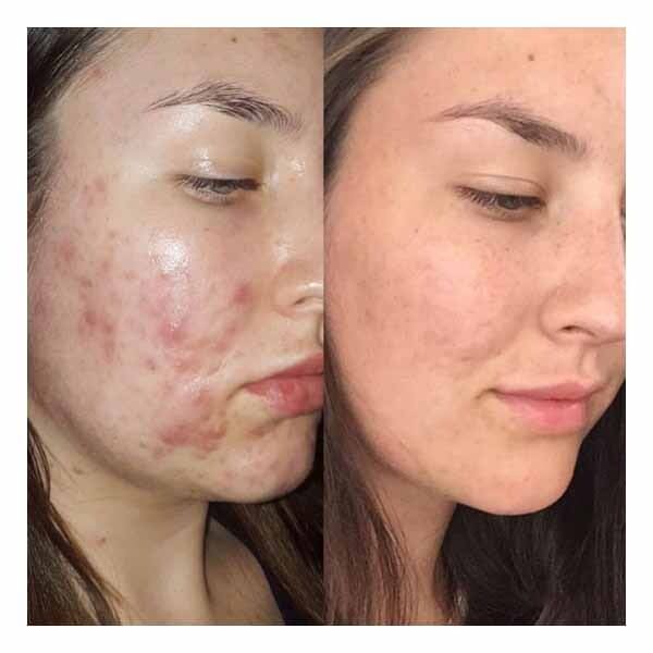 Alya Australian Pink Clay Mask 120Ml | Skin | Superdrug